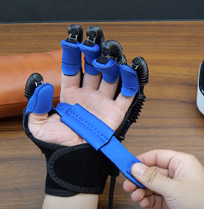 Recovering Hand Function After a Stroke: Essential Exercises and How R ...